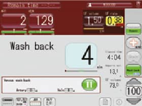 DBB-EXA - Nikkiso Medical