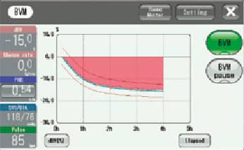 DBB-EXA - Nikkiso Medical