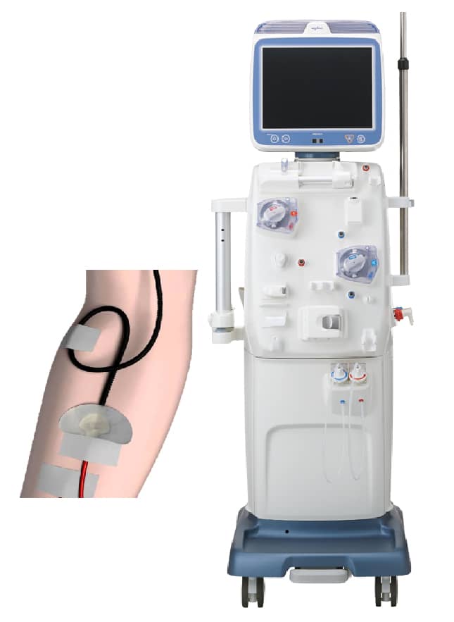 DBB-EXA Ver. 1.5 - Nikkiso Medical